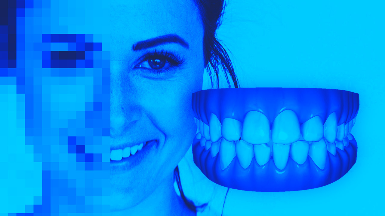 In-Face Visualization for Orthodontic Treatment Planning - iTero Tools ...